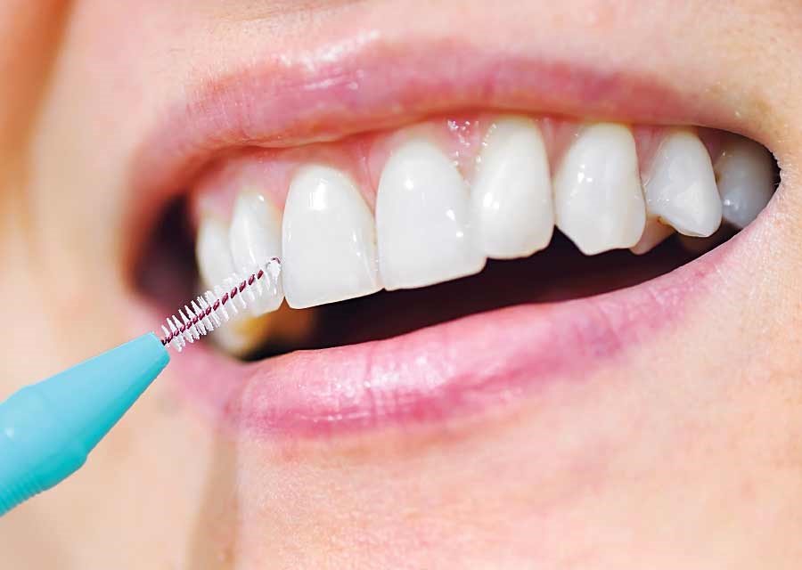 Interdental Cleaning | Blog | Crook Log Dental